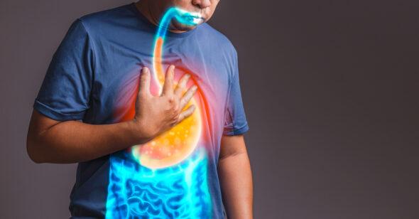 Reflux – príznaky, liečba - KD.sk